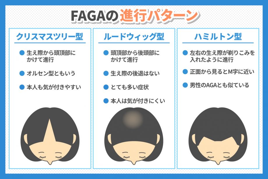 女性の薄毛“FAGA”って何？原因や対策・治療方法と合わせて解説します｜池袋AGAクリニックで発毛治療
